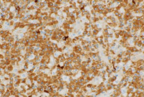 CONFIRM anti-Kappa Rabbit Polyclonal Primary Antibody