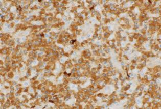 CONFIRM anti-Lambda Rabbit Polyclonal Primary Antibody