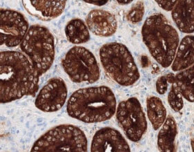 CONFIRM anti-Prostate Specific Antigen (PSA) Rabbit Polyclonal Primary ...