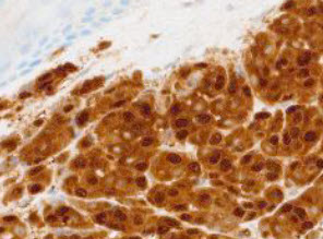 CONFIRM anti-S100 (Polyclonal) Primary Antibody