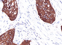Cytokeratin 5/14 (EP1601Y/LL002) Rabbit and Mouse Monoclonal Primary Antibody