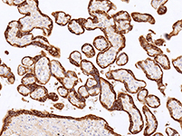 Human Placental Lactogen (hPL) Rabbit Polyclonal Antibody