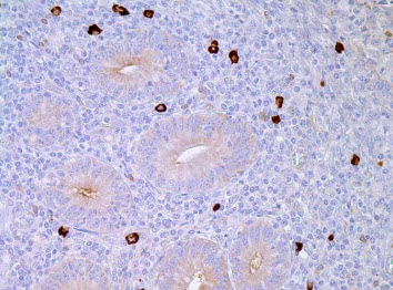 IgM Rabbit Polyclonal Antibody