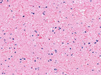 INFORM EBER (Epstein-Barr Virus Early RNA) Probe