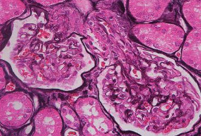 Congo Red Staining Kit