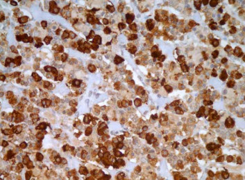 LH Rabbit Polyclonal Antibody