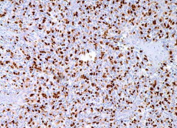 Myogenin (F5D) Mouse Monoclonal Antibody
