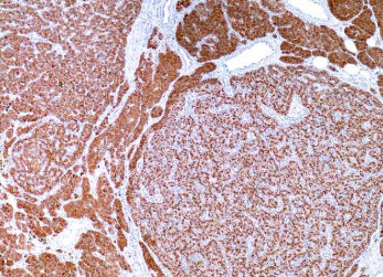 Parathyroid Hormone (PTH) (MRQ-31) Mouse Monoclonal Antibody