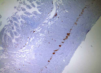 PGP 9.5 Rabbit Polyclonal Antibody