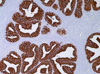 PSAP (PASE/4LJ) Mouse Monoclonal Antibody