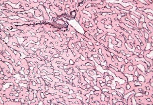 Reticulum II Staining Kit
