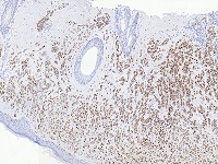 SOX-10 (SP267) Rabbit Monoclonal Primary Antibody