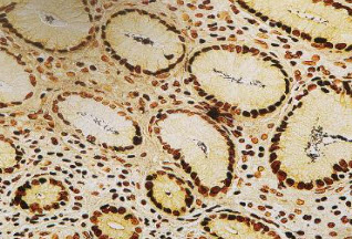 Reticulum II Staining Kit