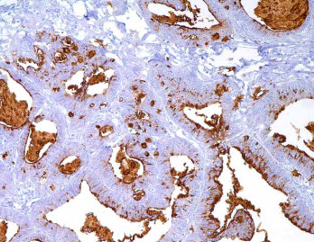 TAG-72 (B72.3) Mouse Monoclonal Antibody