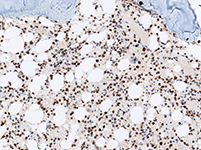 TRAcP (9C5) Mouse Monoclonal Antibody