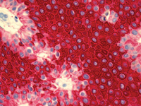 ultraView Universal Alkaline Phosphatase Red Detection Kit