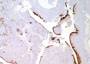 Uroplakin III (SP73) Rabbit Monoclonal Antibody