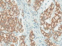 VENTANA® anti-BRAF V600E (VE1) Mouse Monoclonal Primary Antibody, For ...