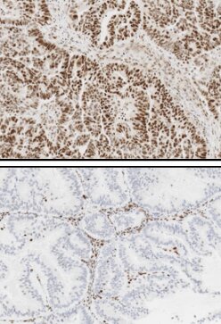 VENTANA® anti-MLH1 (M1) Mouse Monoclonal Primary Antibody, For use with ...