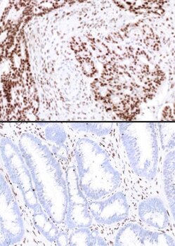 VENTANA® anti-MLH1 (M1) Mouse Monoclonal Primary Antibody, For use with ...