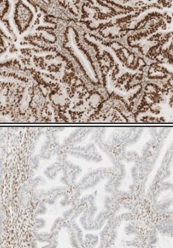 VENTANA® anti-MSH2 (G219-1129) Mouse Monoclonal Primary Antibody, For ...