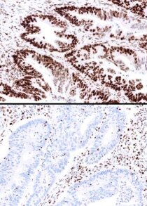 VENTANA® anti-MSH6 (SP93) Rabbit Monoclonal Primary Antibody, For use ...