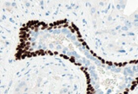 VENTANA® anti-p63 (4A4) Mouse Monoclonal Primary Antibody