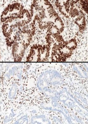 VENTANA® anti-PMS2 (A16-4) Mouse Monoclonal Primary Antibody, For use ...