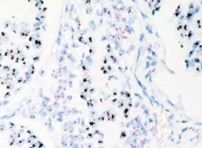 VENTANA HER2 Dual ISH DNA Probe Cocktail