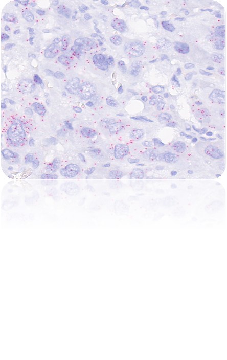 DISCOVERY mRNA RED Probe Amplification Kit