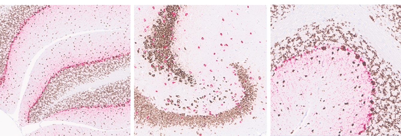 DISCOVERY mRNA RED Detection Kit